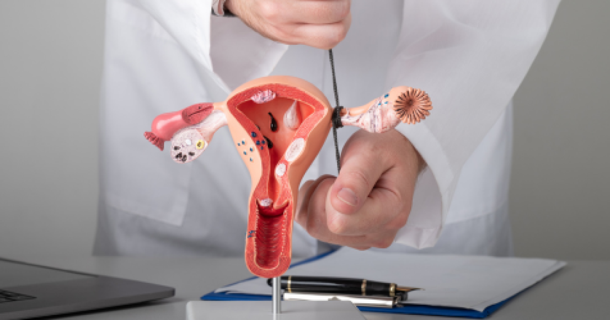 Tubal Ligation in Turkey: Closing The Baby Factory | Cevre Hospital
